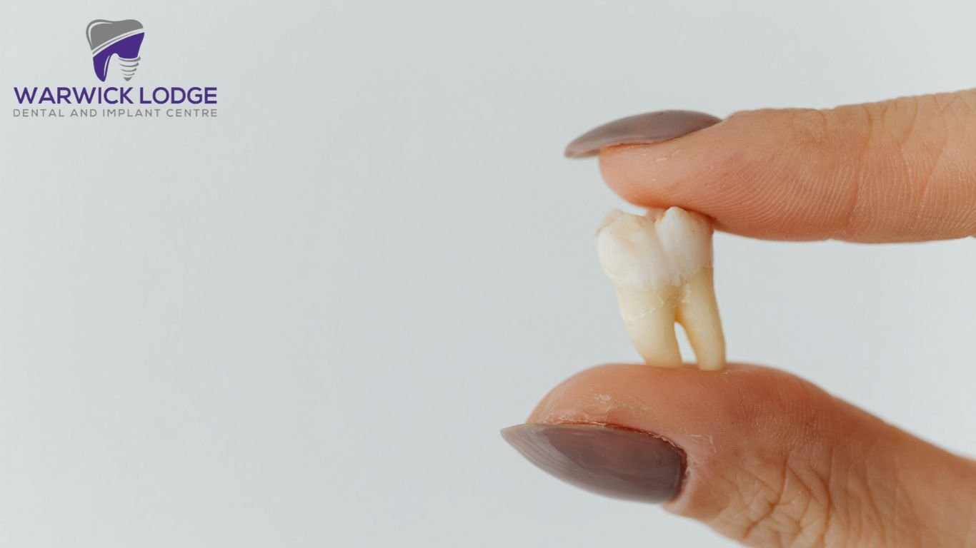 Surgical Tooth Extractions: A Complete Guide - Warwicklodge Dental